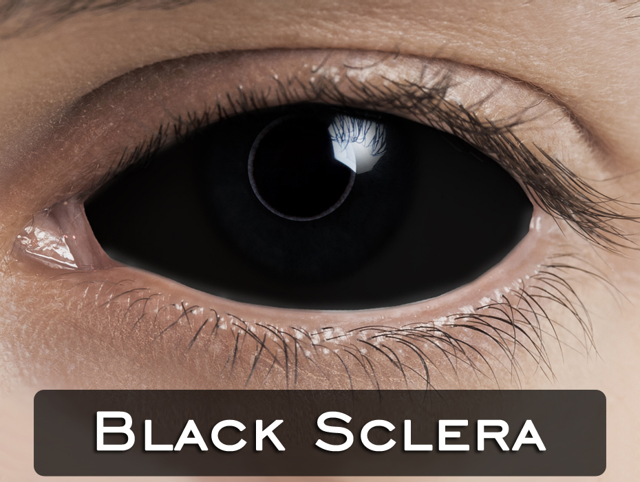 Sclera